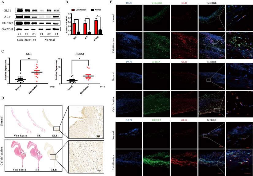Gli1 promotes the phenotypic transformation of valve interstitial cells ...