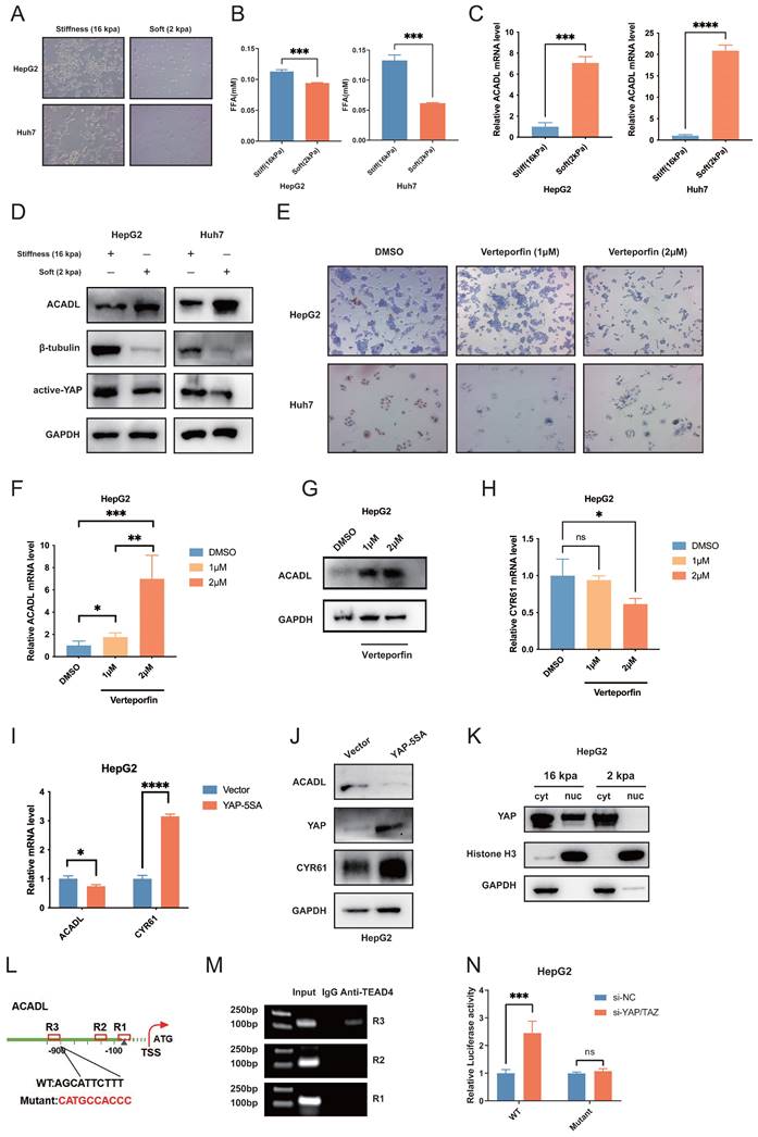 Bulk and single-cell transcriptome profiling reveal extracellular ...