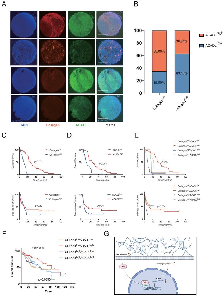 Bulk and single-cell transcriptome profiling reveal extracellular ...