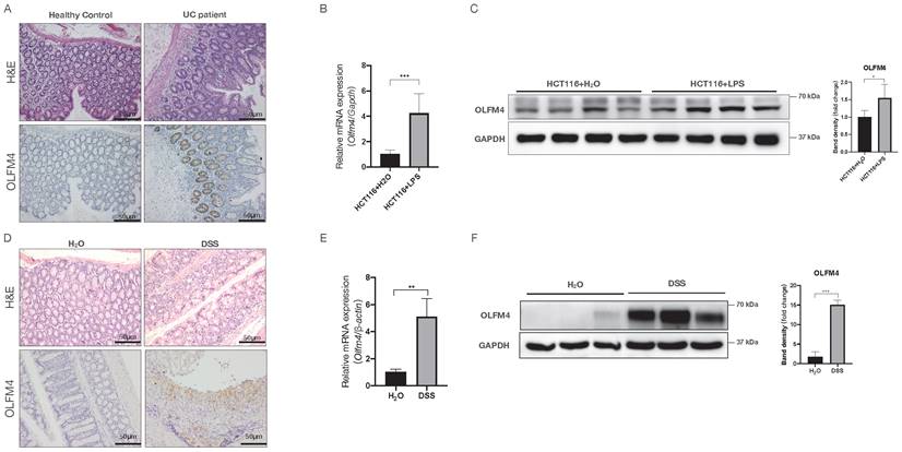 Olfactomedin-4 deletion exacerbates DSS-induced colitis through a ...