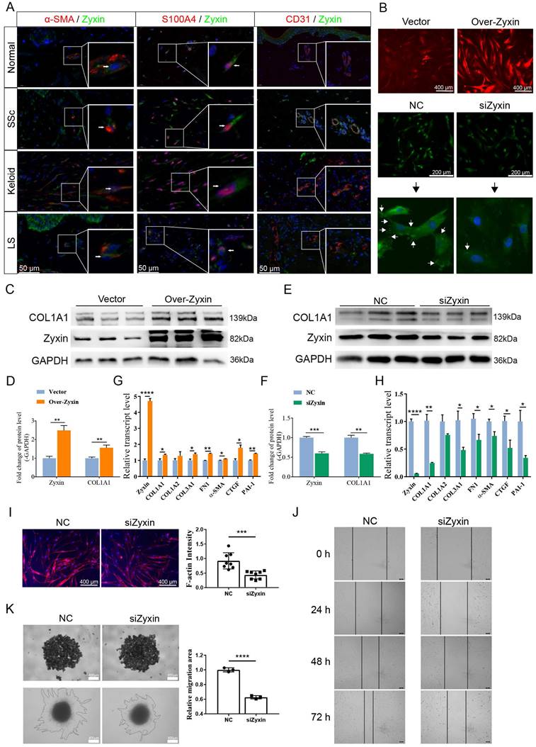 Enhancement of Zyxin Promotes Skin Fibrosis by Regulating FAK/PI3K/AKT ...