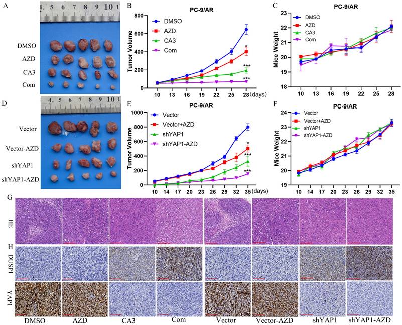 YAP1 synergize with YY1 transcriptional co-repress DUSP1 to induce ...