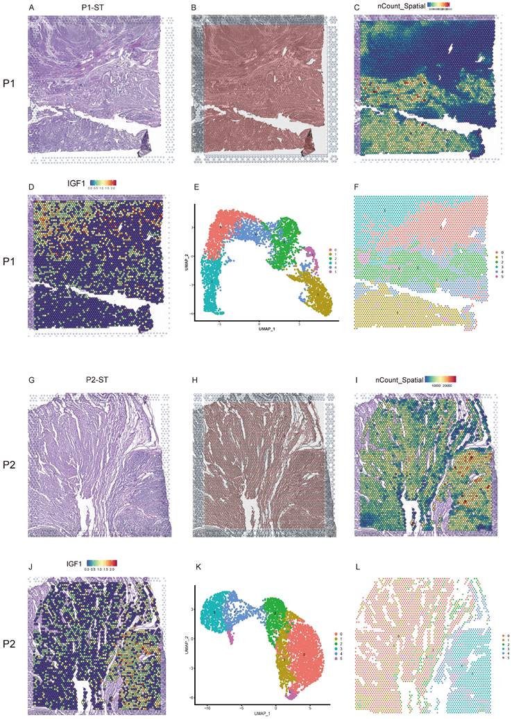 Integrating Spatial Transcriptomics and Single-nucleus RNA Sequencing ...
