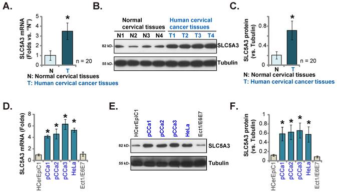 SLC5A3 is important for cervical cancer cell growth