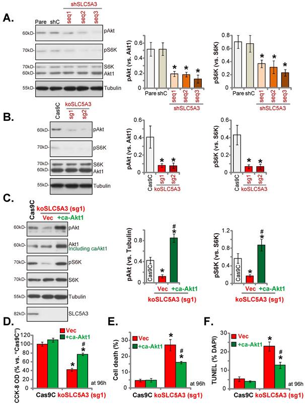SLC5A3 is important for cervical cancer cell growth