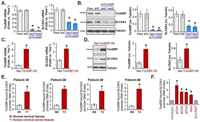 SLC5A3 is important for cervical cancer cell growth