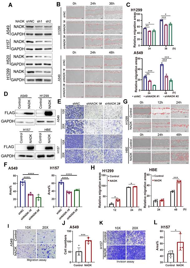 Nicotinamide adenine dinucleotide kinase promotes lymph node metastasis ...