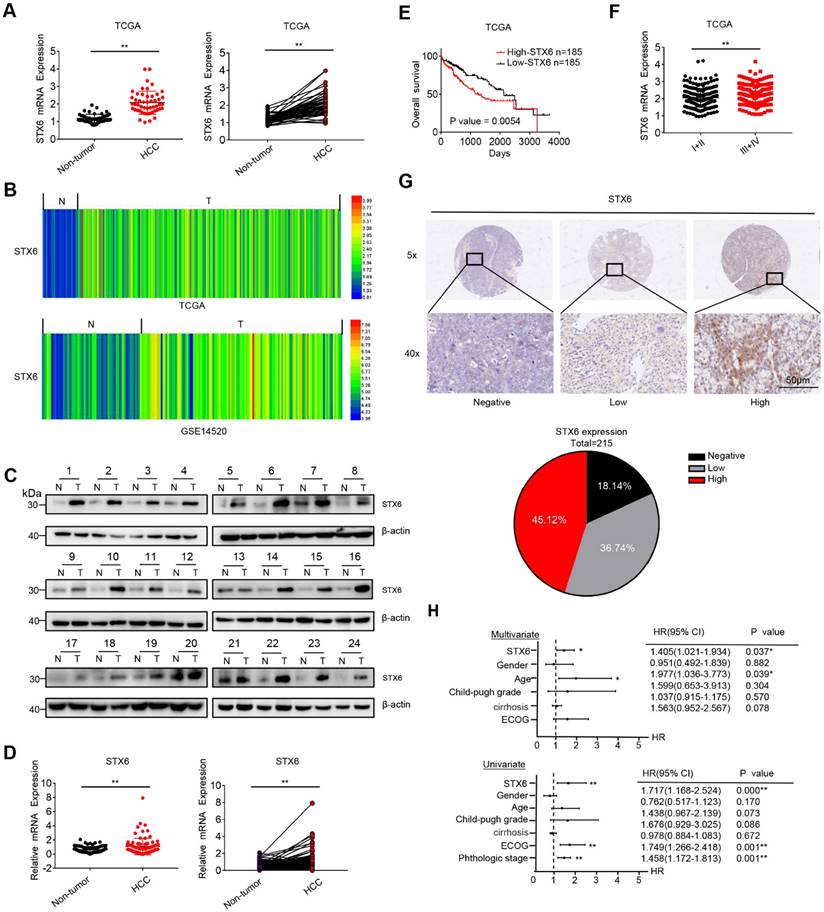 Syntaxin-6 promotes the progression of hepatocellular carcinoma and ...