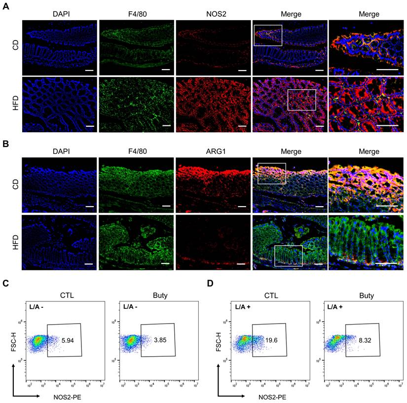 High-fat diet promotes colitis-associated tumorigenesis by altering gut ...