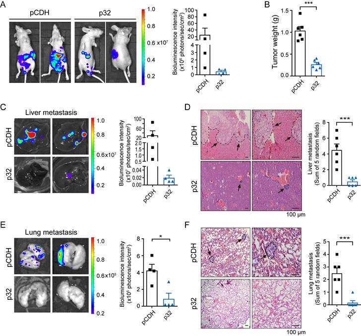 p32 regulates glycometabolism and TCA cycle to inhibit ccRCC ...