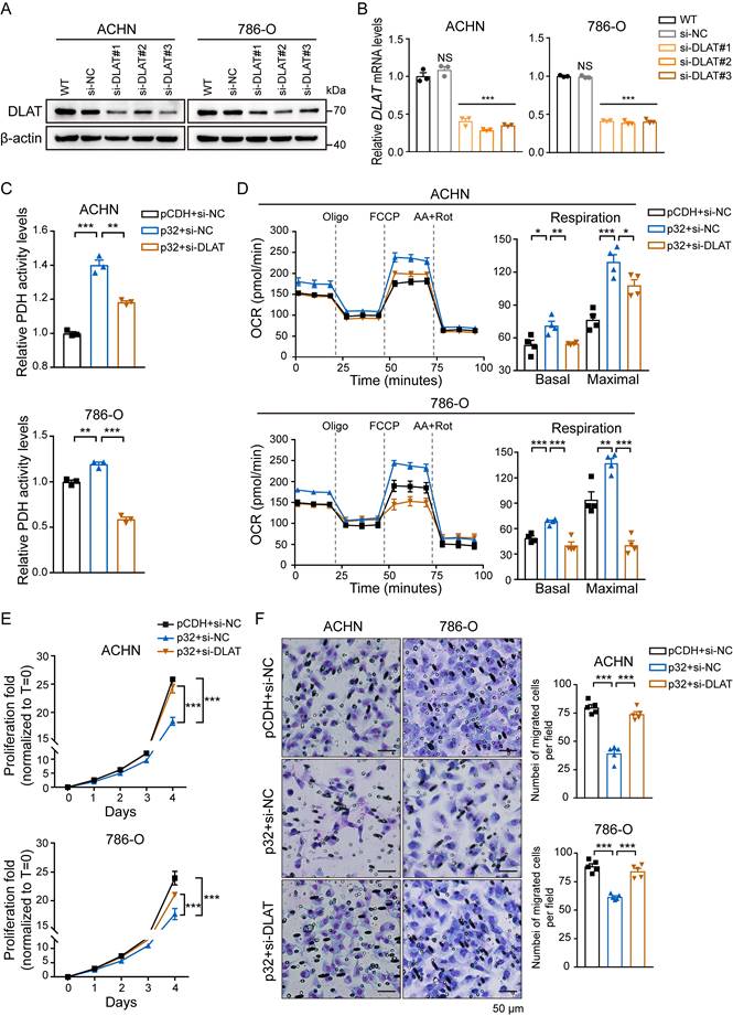 p32 regulates glycometabolism and TCA cycle to inhibit ccRCC ...