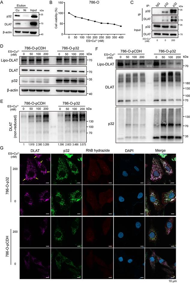 p32 regulates glycometabolism and TCA cycle to inhibit ccRCC ...
