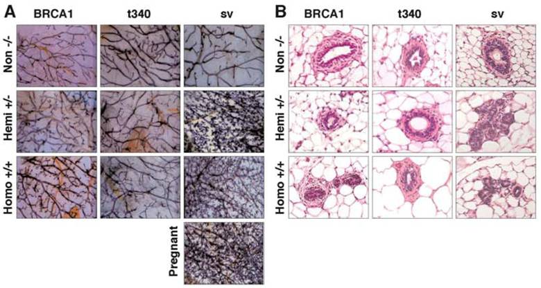 Effects of BRCA1 Transgene Expression on Murine Mammary Gland ...