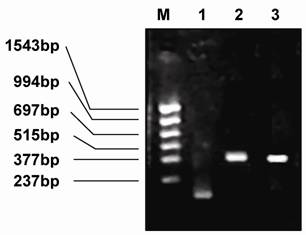 Screening of Human Antibody Fab Fragment against HBsAg and the ...