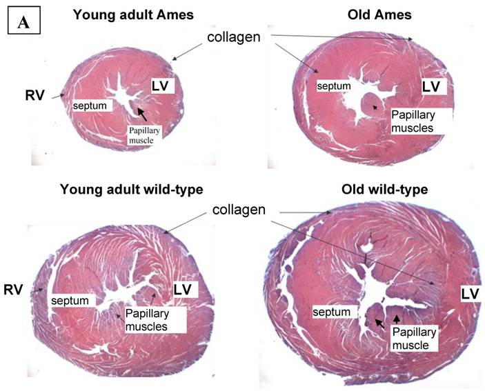 Smaller cardiac cell size and reduced extra-cellular collagen might be ...