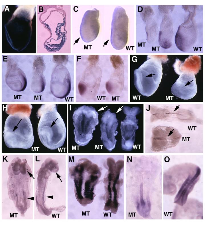 Anterior Visceral Endoderm SMAD4 Signaling Specifies Anterior Embryonic ...