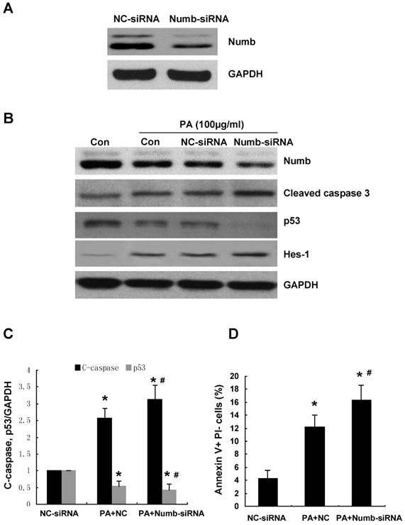 Numb Protects Renal Proximal Tubular Cells from Puromycin ...