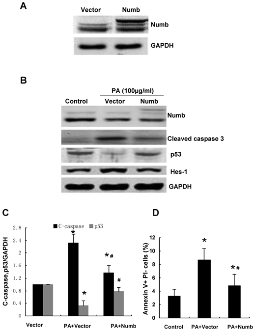 Numb Protects Renal Proximal Tubular Cells from Puromycin ...