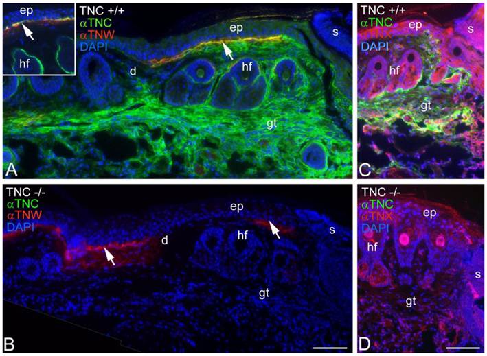 The Adhesion Modulating Properties of Tenascin-W
