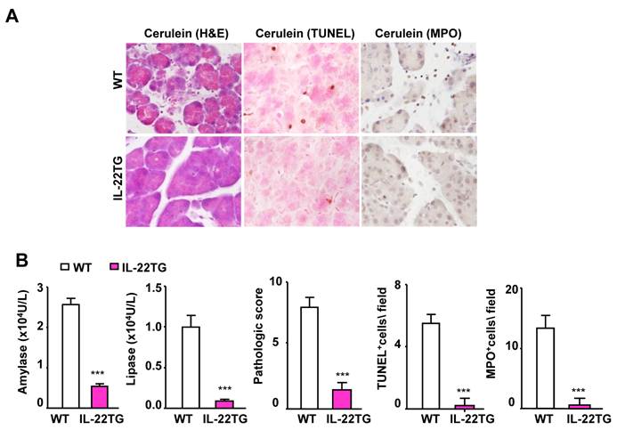 Interleukin-22 Ameliorates Cerulein-Induced Pancreatitis in Mice by ...