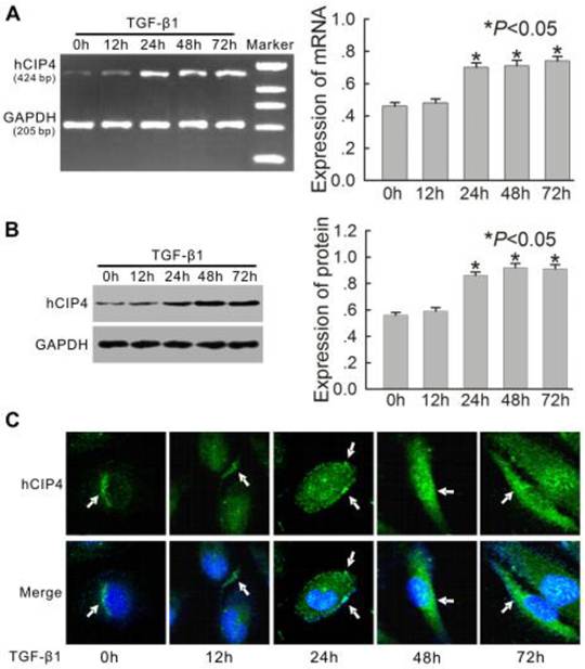 Cdc42-Interacting Protein-4 Promotes TGF-Β1-Induced Epithelial ...