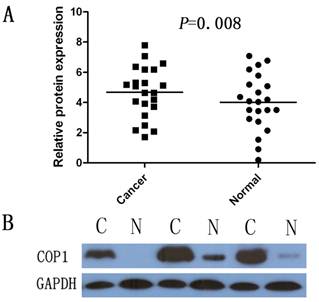 High Level of COP1 Expression is Associated with Poor Prognosis in ...