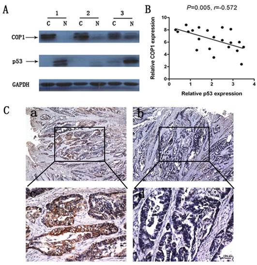 High Level of COP1 Expression is Associated with Poor Prognosis in ...
