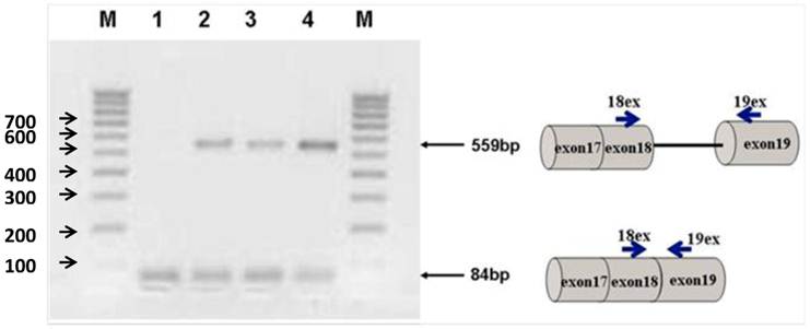Tuning of Alternative Splicing - Switch From Proto-Oncogene to Tumor ...