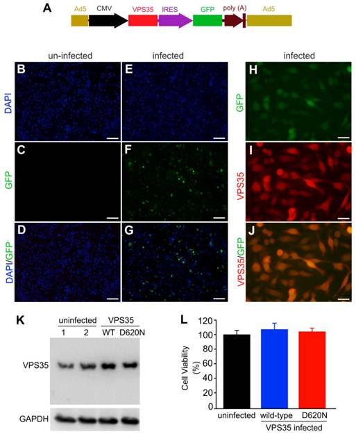 Pathogenic Mutation in VPS35 Impairs Its Protection against MPP+ ...