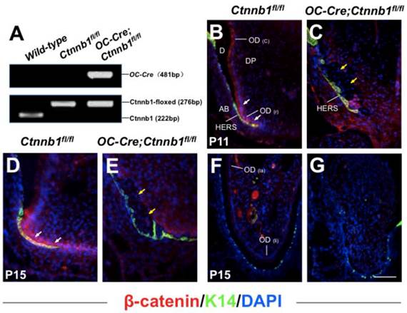 Disruption of Wnt/β-catenin Signaling in Odontoblasts and Cementoblasts ...