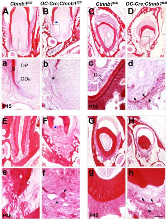 Disruption of Wnt/β-catenin Signaling in Odontoblasts and Cementoblasts ...