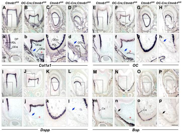 Disruption of Wnt/β-catenin Signaling in Odontoblasts and Cementoblasts ...