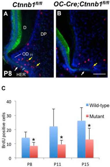 Disruption of Wnt/β-catenin Signaling in Odontoblasts and Cementoblasts ...