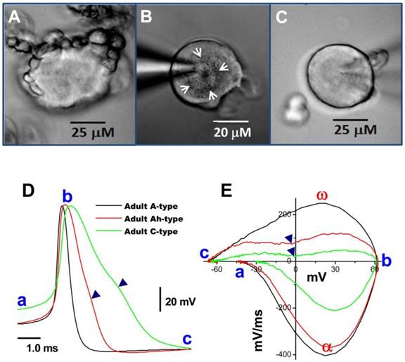 Subtype Identification in Acutely Dissociated Rat Nodose Ganglion ...