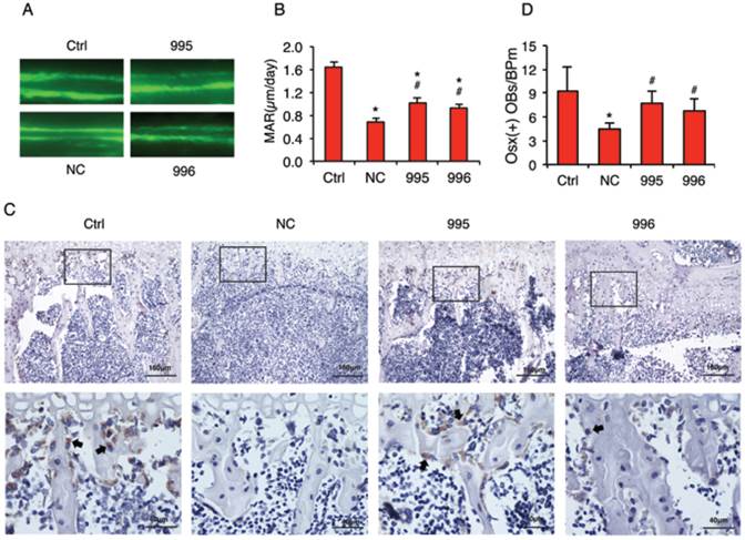 PTHrP Expression in Human MDA-MB-231 Breast Cancer Cells Is Critical ...