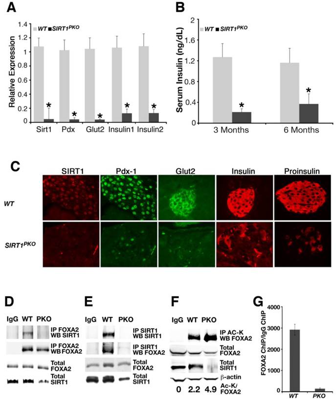 SIRT1 Deacetylates FOXA2 and Is Critical for Pdx1 Transcription and β ...