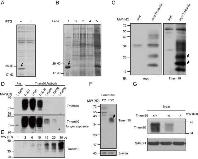 Identification of Tmem10 as a Novel Late-stage Oligodendrocytes Marker ...