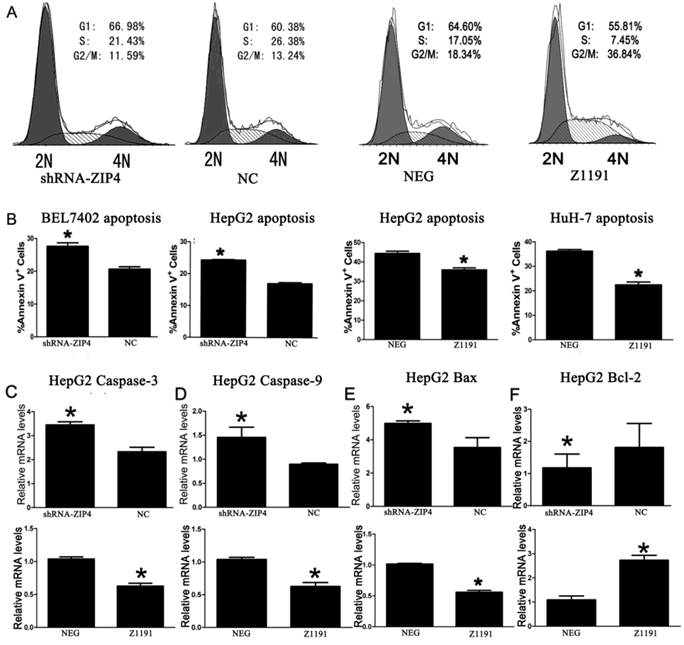 ZIP4, a Novel Determinant of Tumor Invasion in Hepatocellular Carcinoma ...