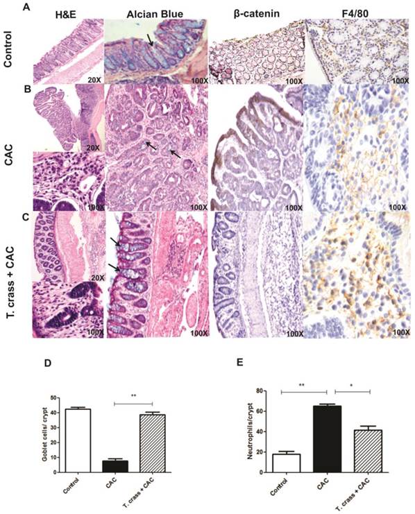 Extraintestinal Helminth Infection Reduces the Development of Colitis ...