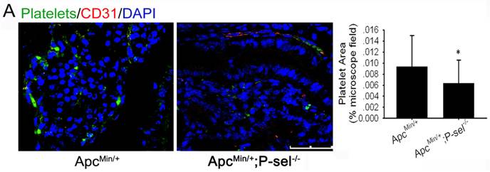 P-Selectin-Mediated Adhesion between Platelets and Tumor Cells Promotes ...