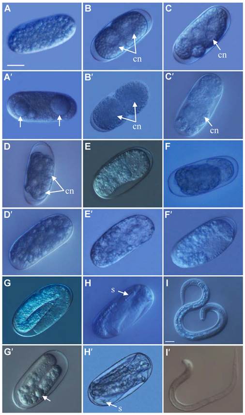Cathepsin B Cysteine Proteinase is Essential for the Development and ...