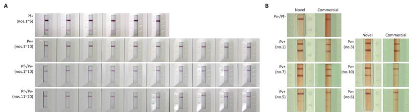A Novel Malaria Pf/Pv Ab Rapid Diagnostic Test Using a Differential ...