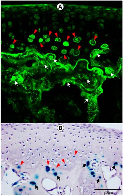 Dmp1 Null Mice Develop a Unique Osteoarthritis-like Phenotype