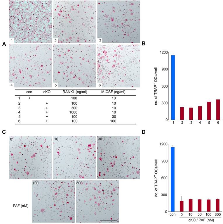 LIS1 Regulates Osteoclastogenesis through Modulation of M-SCF and RANKL ...