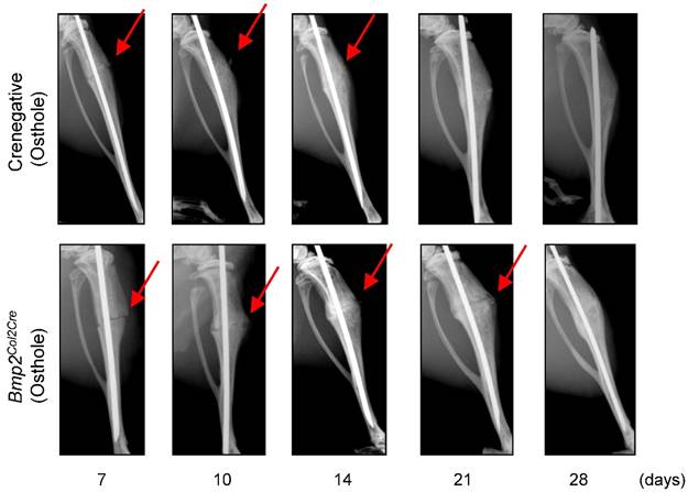 Bone Remodeling X Ray