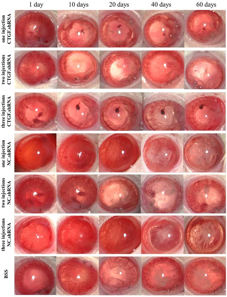 CTGF Contributes to the Development of Posterior Capsule Opacification ...
