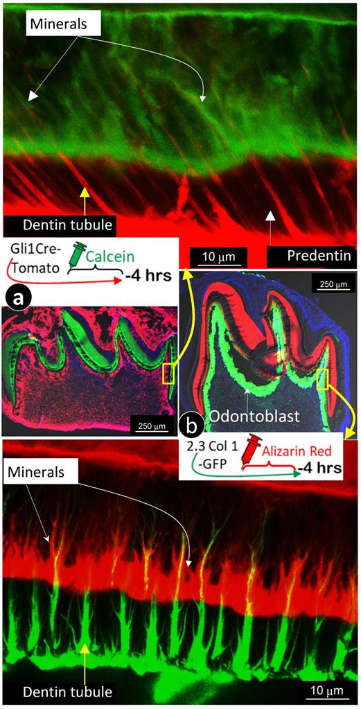 Dentinal mineralization is not limited in the mineralization front but ...
