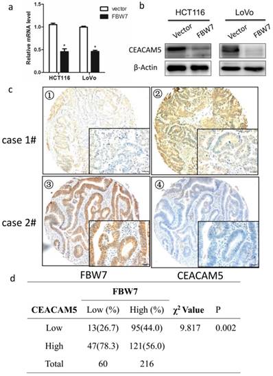 FBW7 suppresses metastasis of colorectal cancer by inhibiting HIF1α ...