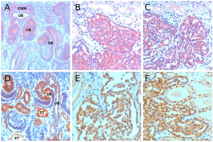 Recalling Cohnheim's Theory: Papillary Renal Cell Tumor as a Model of ...