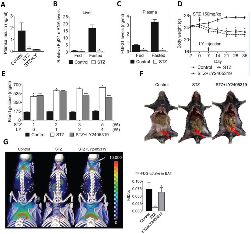 The role of FGF21 in type 1 diabetes and its complications
